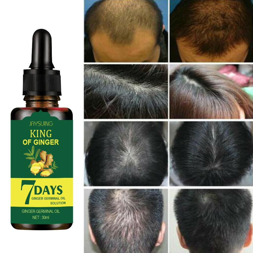Jaysuing King of Ginger 7 Days Ginger Hair Nutrient Solution / Ginger ... Jaysuing King of Ginger 7 Days Ginger Hair Nutrient Solution / Ginger ...