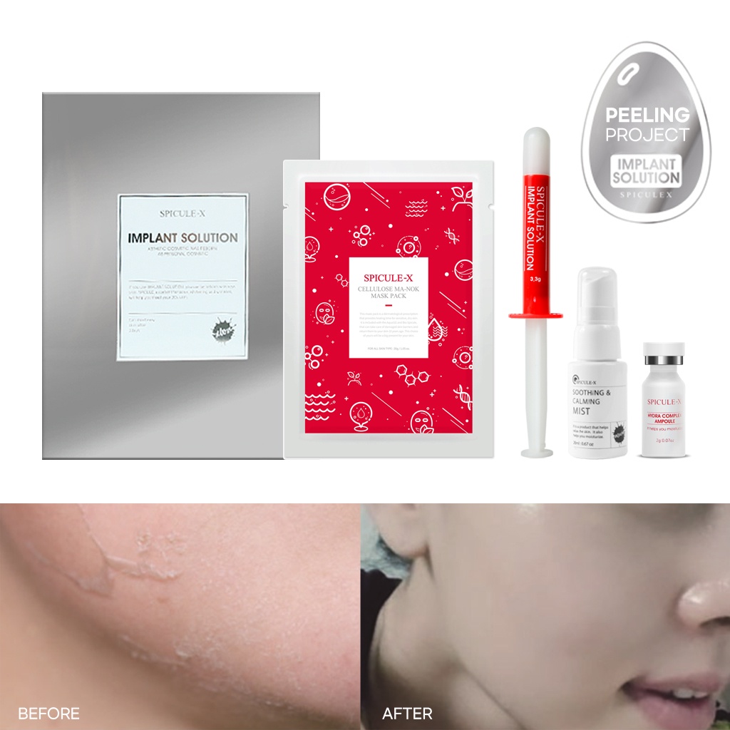 [Spicule-X] Filling Self-Filling Seaweed Filling Herbal Filling ...