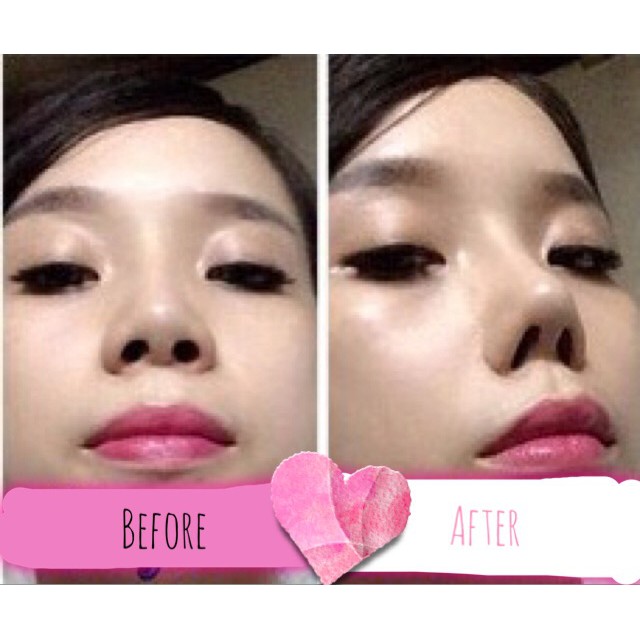 Nose Secret - Instant Nose Job (Nose Inserts) | Shopee Singapore