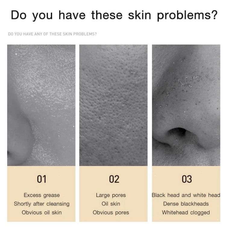 HUNMUI Rejuvenating and Tearing Mask / Peel-off Mask Clean Pores and ...