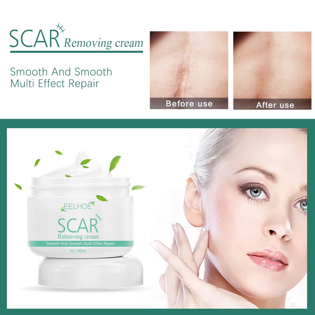 EELHOE Scar Removing Cream 30ml Scar repair cream Desalt burn marks Old ...