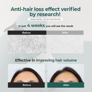 [GRAFEN] Root Booster Shampoo 500ml [No.1 Anti-Hair Loss Shampoo, 22 ...