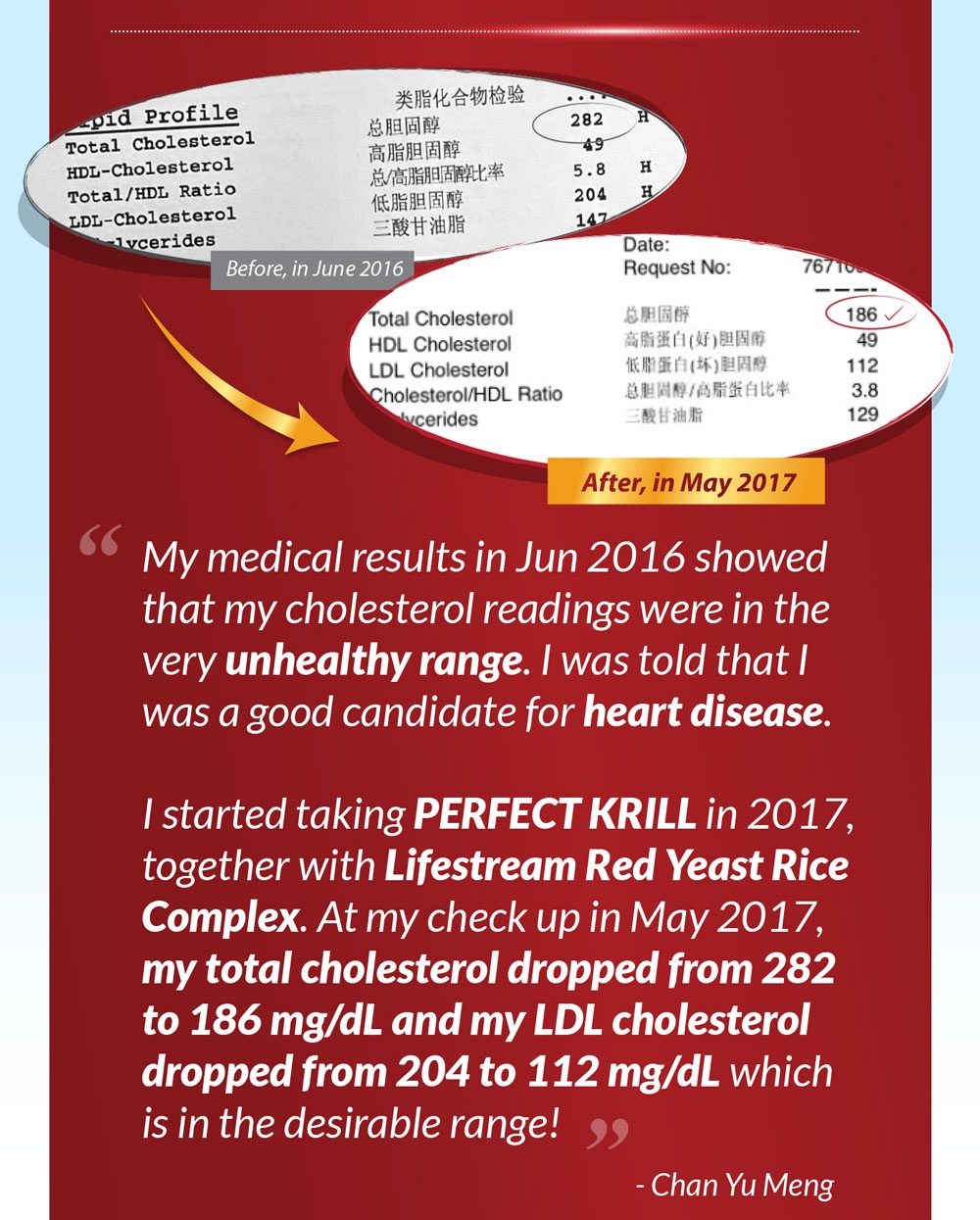 [2 Boxes]LABO Nutrition Perfect Krill 1000mg Antarctic Krill Oil Omega ...