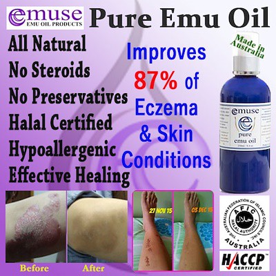 Australia Emuse 100% Pure Emu Oil 50ml | Effective for Eczema and All ...