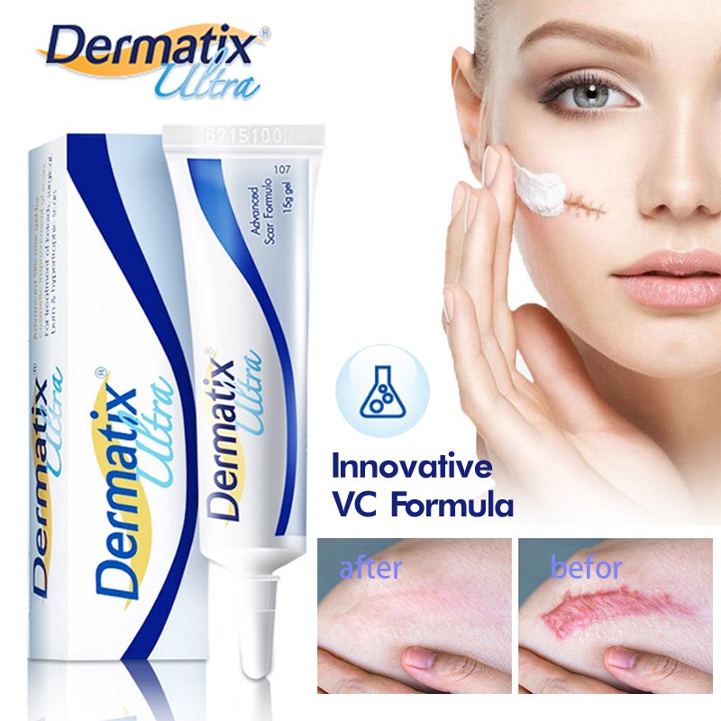 [ REDUCTION SGD 0.34 ] Dermatix Ultra Gel Dermatix 15Gr Cream Remove ...