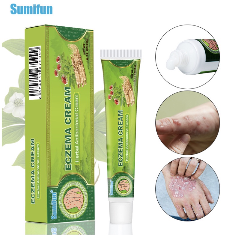 Psoriasis Cream Antibacterial Antipruritic Dermatitis Eczema Herbal