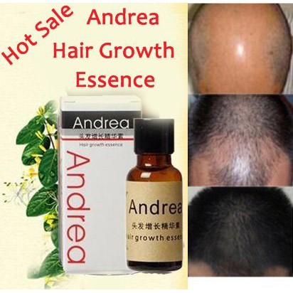 SG Ready Stock Andrea Hair Growth Essence / Andrea Hair Growth Serum ...