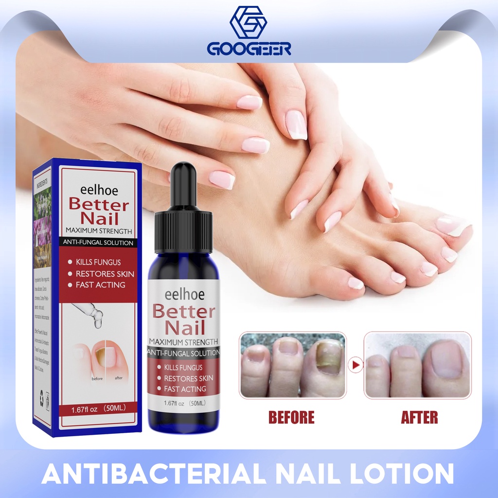 Anti Fungal Nail Gel Fungal Nails Treatment Serum Hand Foot Cream