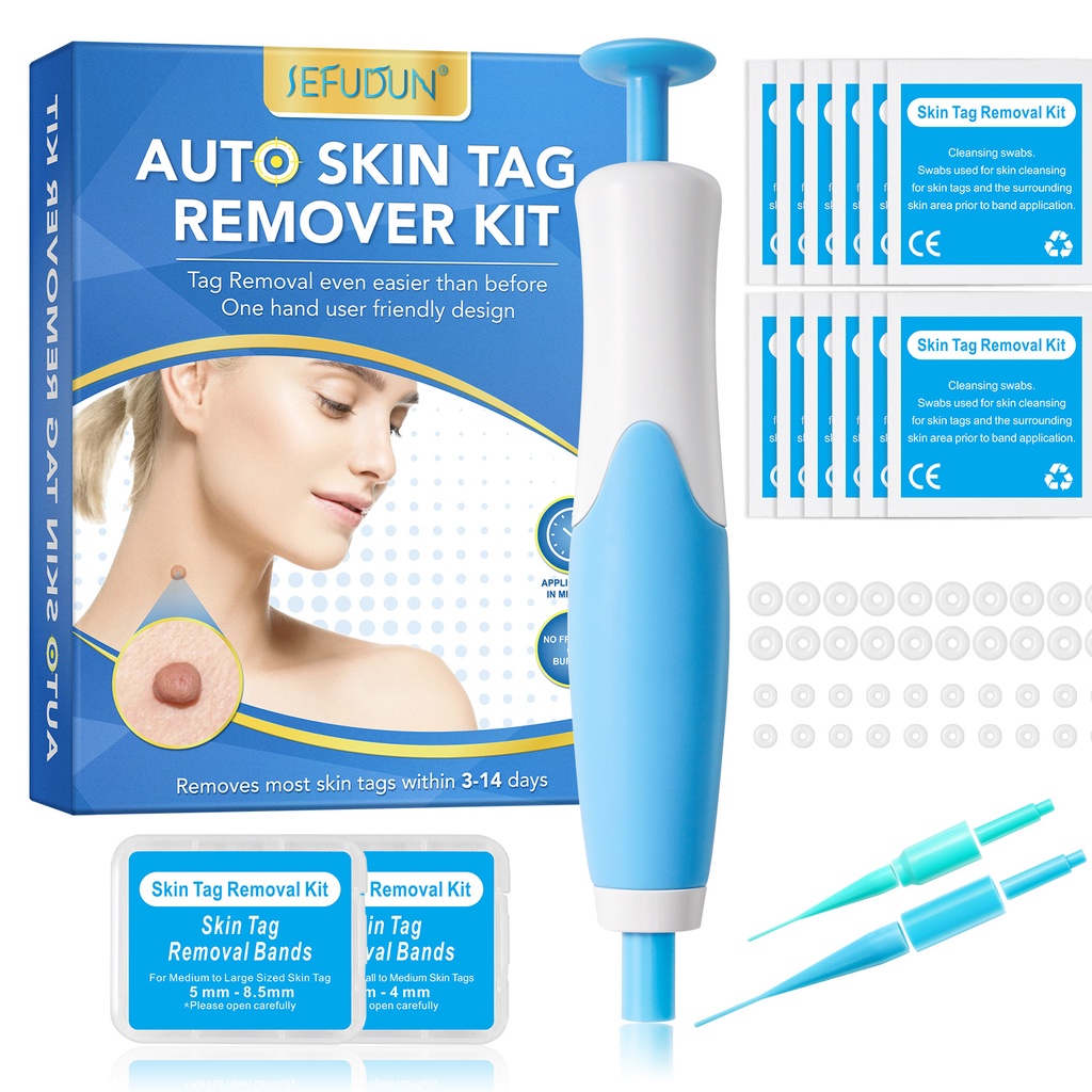 Skin Tag Kill Skin Mole Wart Remover Band, Skin Tag Removal Kit, Corn ...