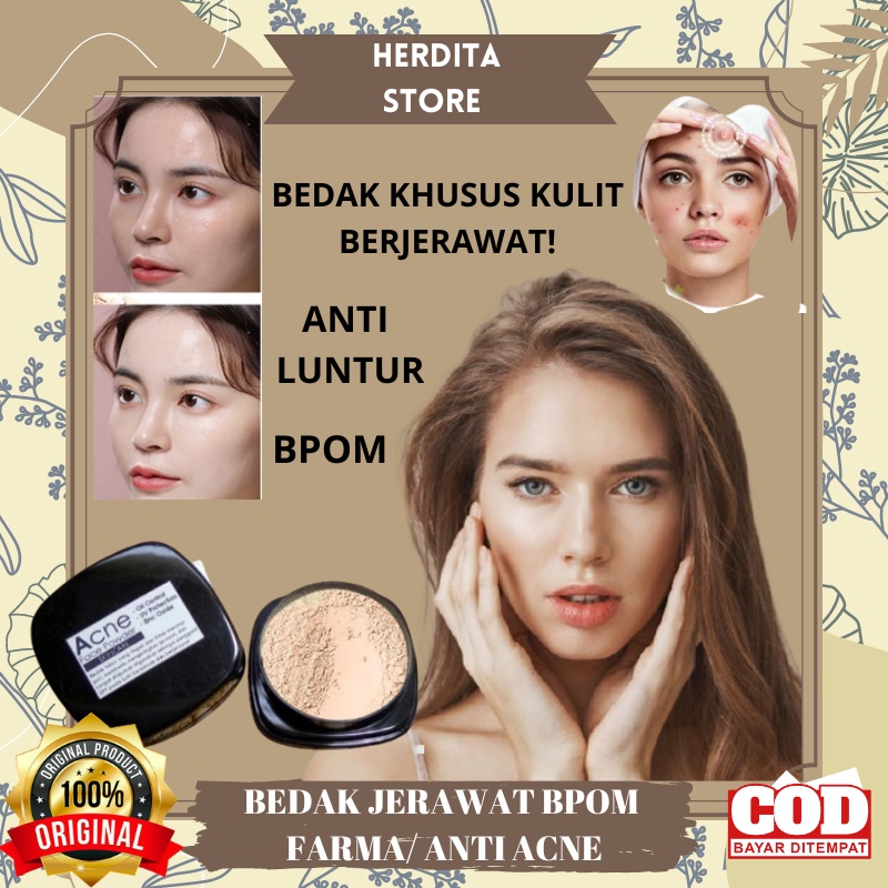 Acne Powder, Acne Powder, Reduce Oil On Face, Acne Powder, Acne And ...