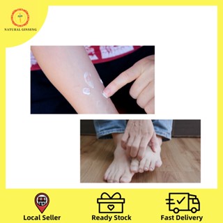 YSP Antifungal Cream 10g For topical treatment of tinea pedis, tinea ...