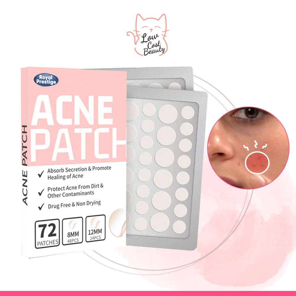 72 patch Royal Prestige Acne Pimple Patch Acne Treatment Stickers Anti ...