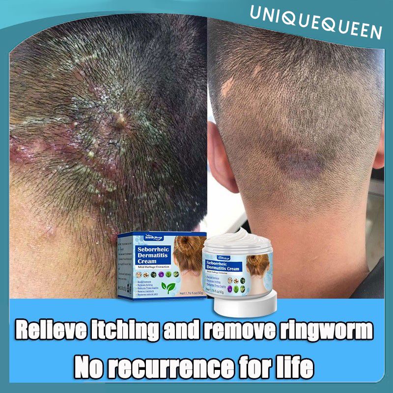Mini Skin Repair Cream Head Seborrheic Dermatitis Cream Repair Hair ...